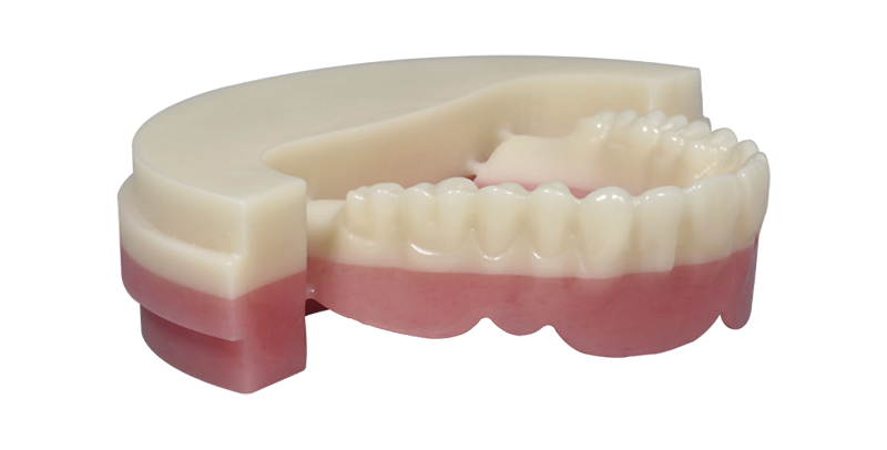 Full denture - LeonardoDental