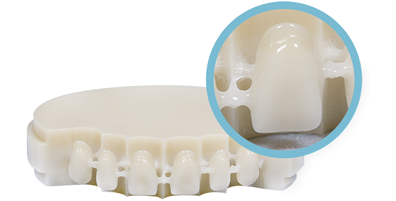 Multilayer - LeonardoDental